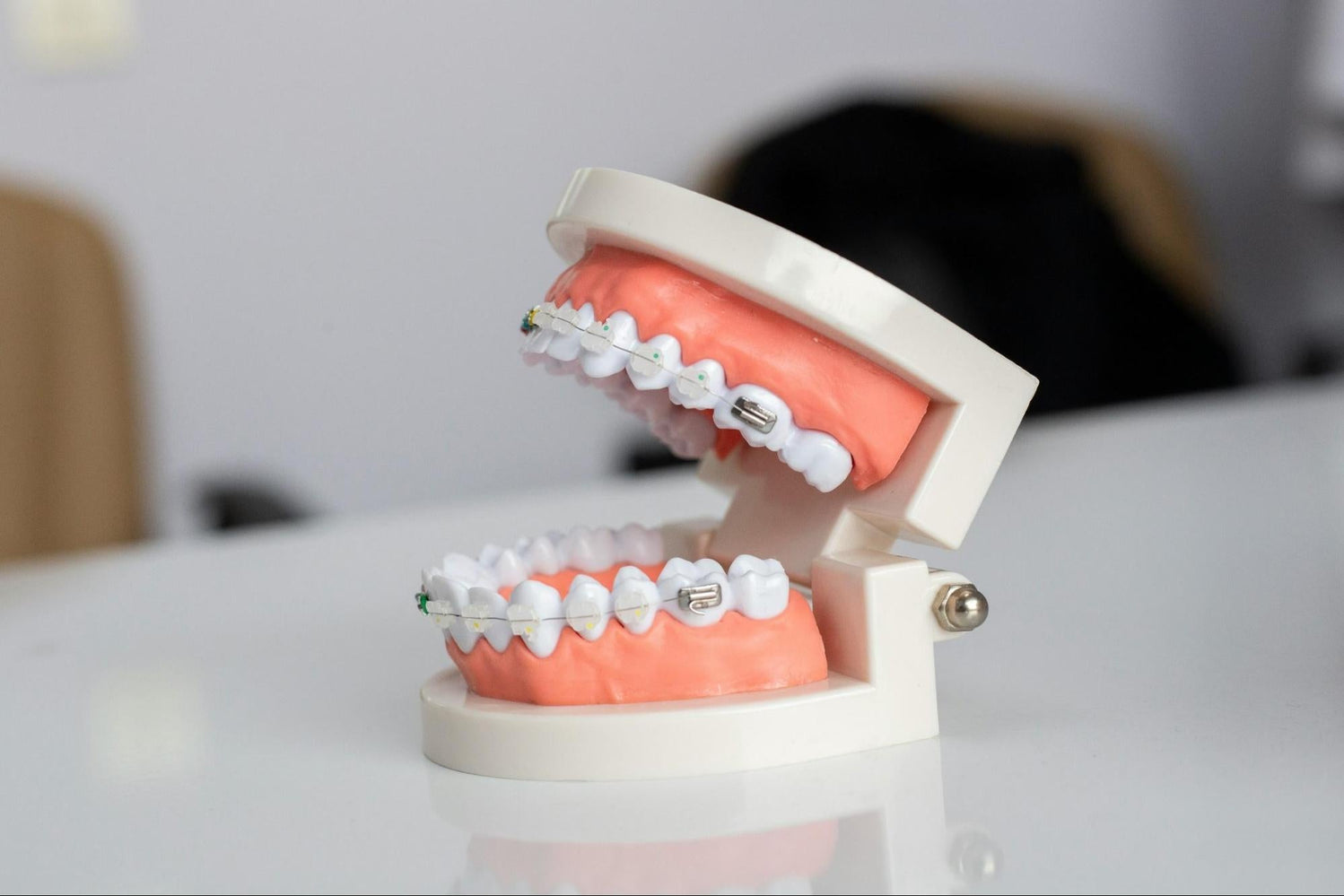 Composite Bonding: Composite veneers vs Edge Bonding – Enlighten Smiles